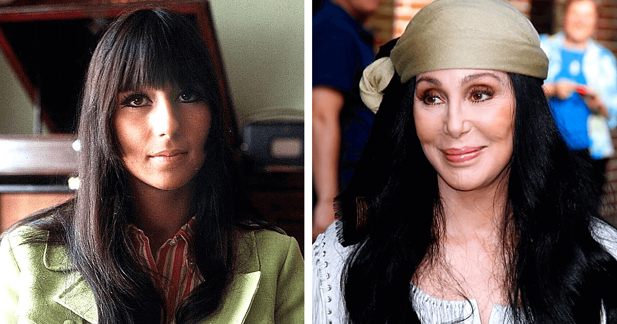 Cher's story of plastic surgery addiction and her daughter's decision ...