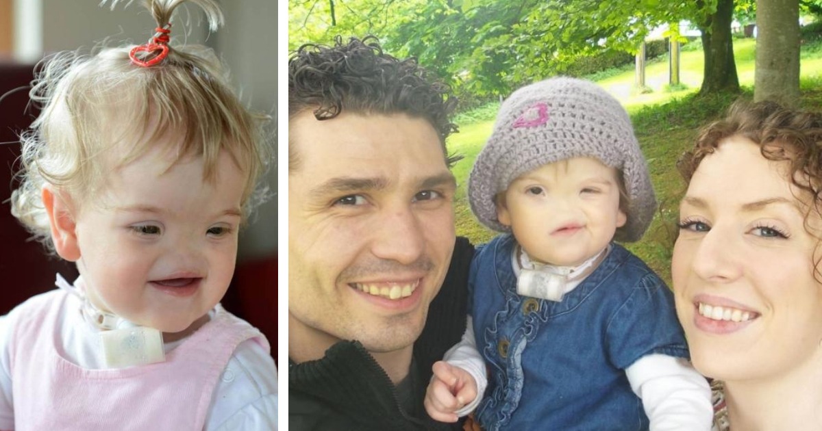 The girl who was born without a nose is already 8 years old! What does ...