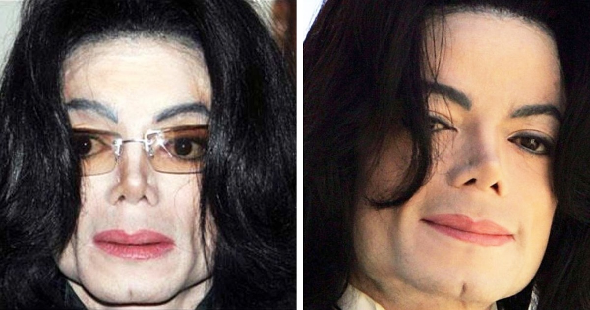 "Before All Plastic Procedures": How Michael Jackson's Appearance Has ...