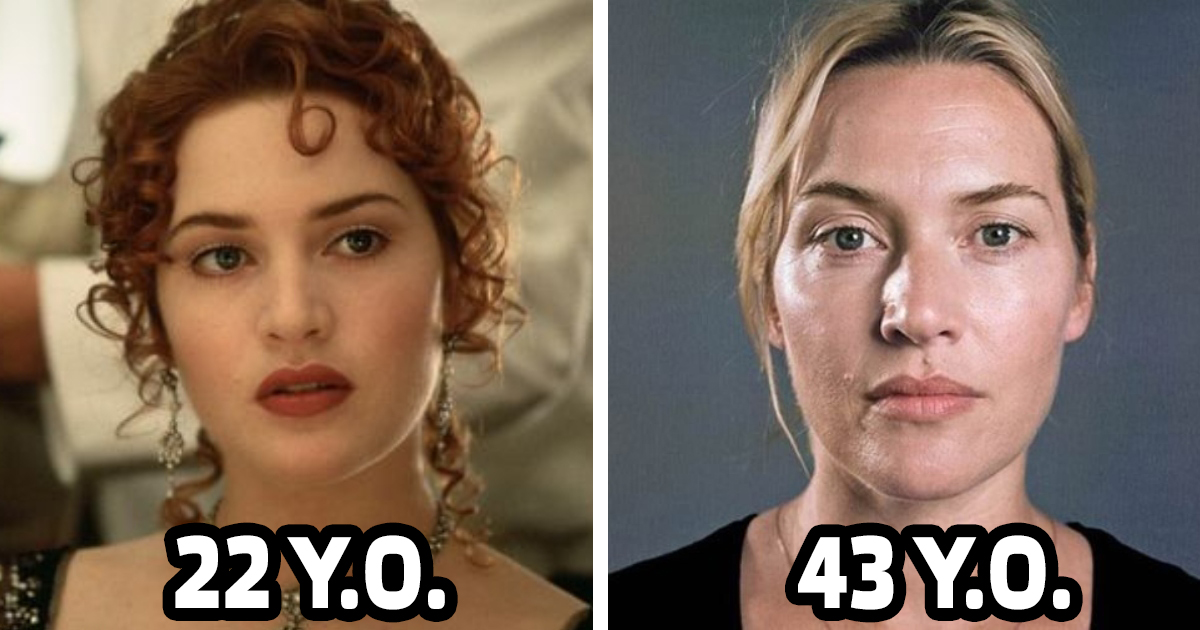 "They Said No To Facelifts": What Do The Stars Who Have Decided To Age ...