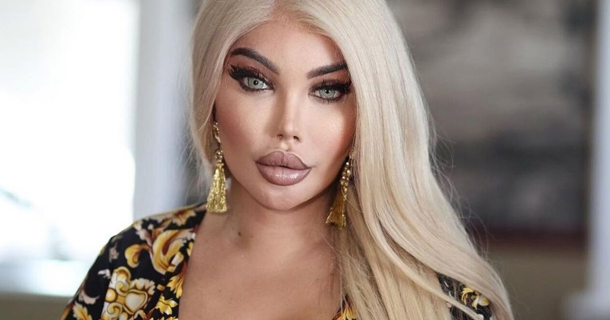 "Artificial Beauty": The Model, Who Has Had 74 Plastic Surgeries ...